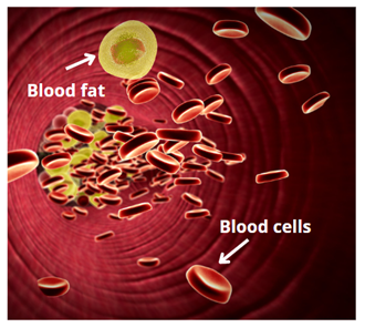 Cholesterol (Blood Fats) - Guide for Stroke Recovery